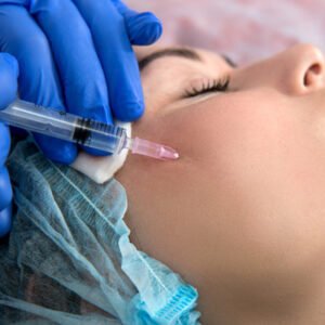 Facial Mesotherapy - Estepalace